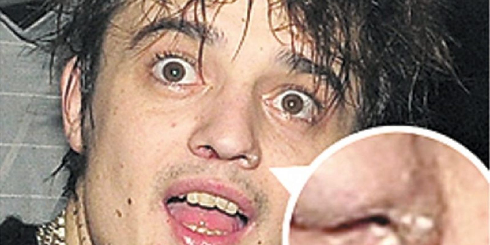 Celebridades, la nueva cara de las drogas | Publimetro Chile