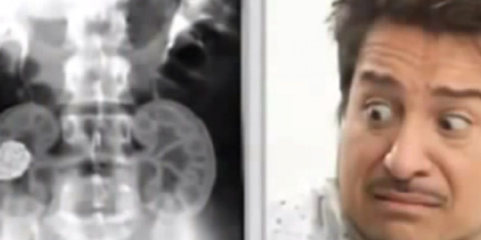 Revive algunos "stand-up comedy" de Luis Raúl | Metro